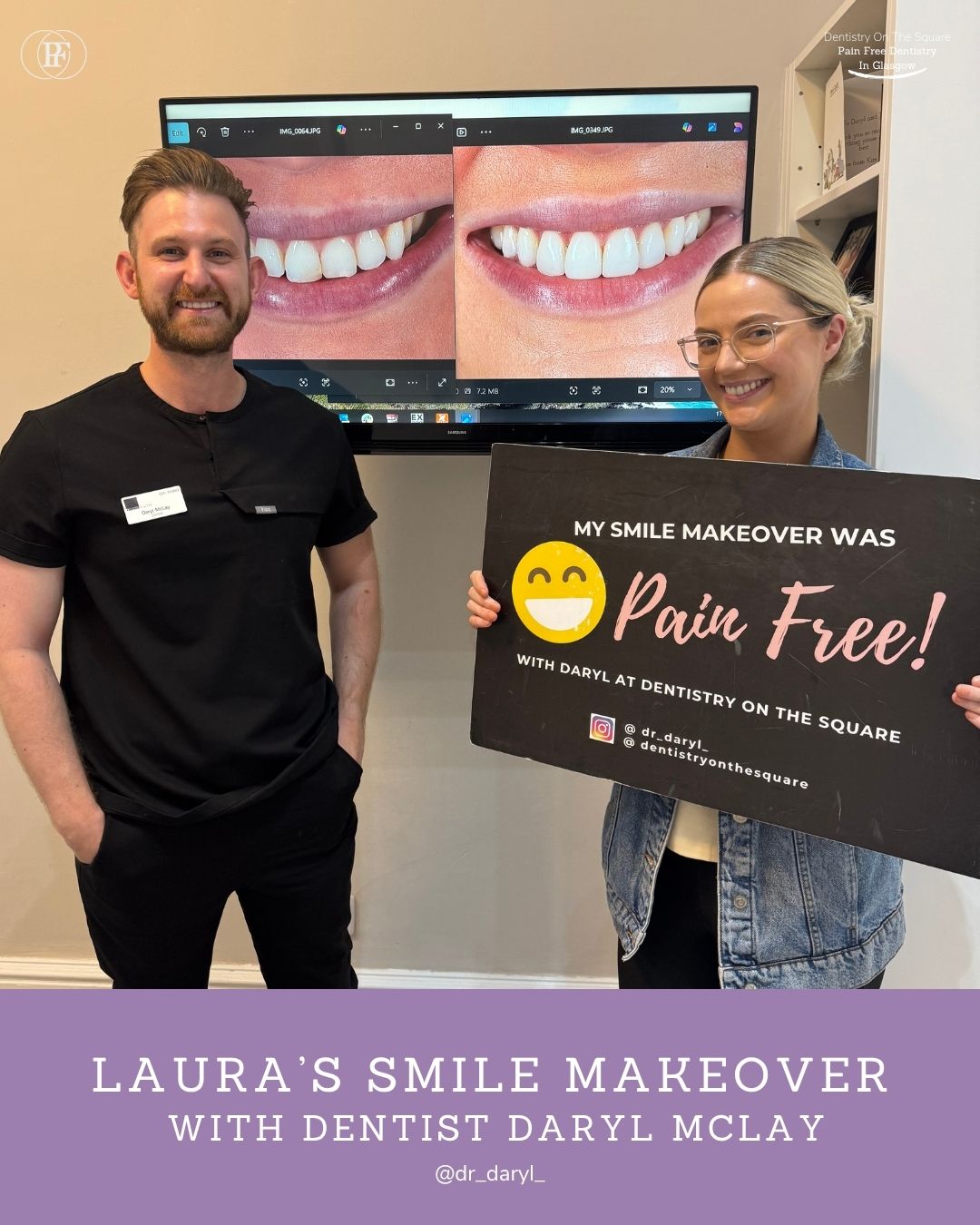 Laura’s Smile Story - Dentistry On The Square, Pain Free Dentist Glasgow